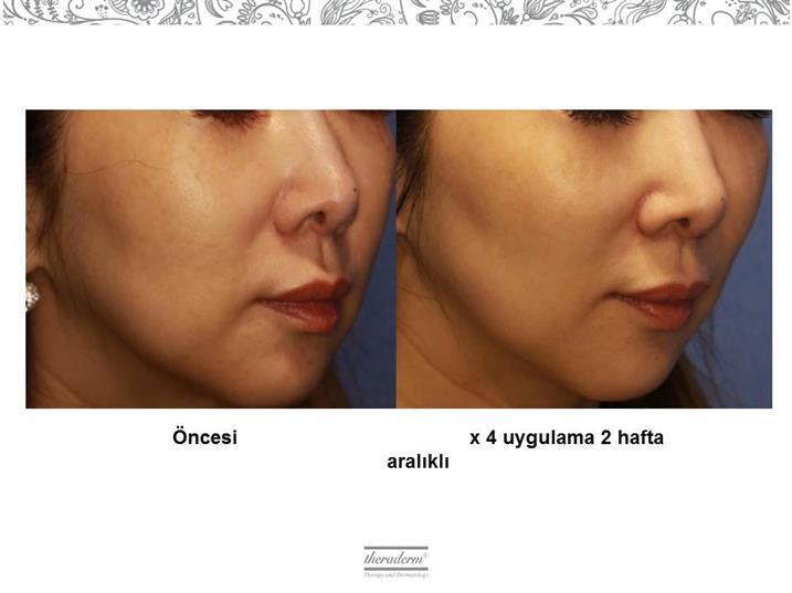 Pink Magic Cream 50 ml - Cilt Bakım Ürünleri